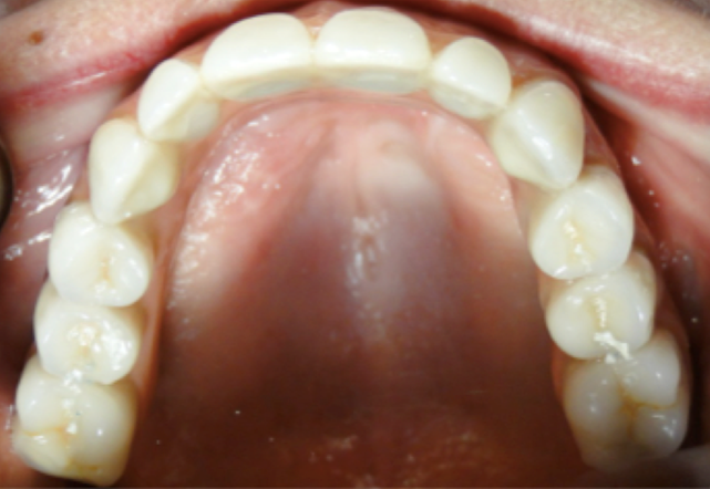 Before and After Toronto | Periodontal Specialists